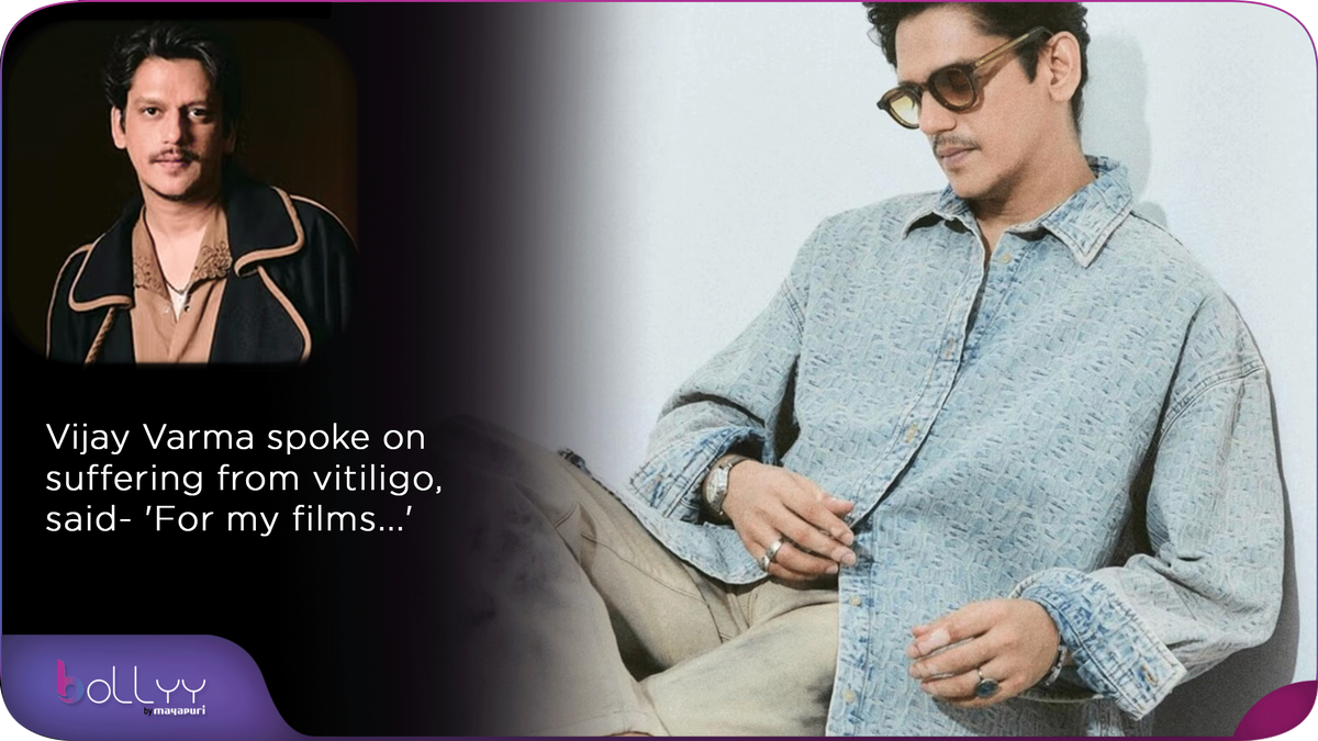 Vijay Varma spoke on suffering from vitiligo, said- 'For my films...'