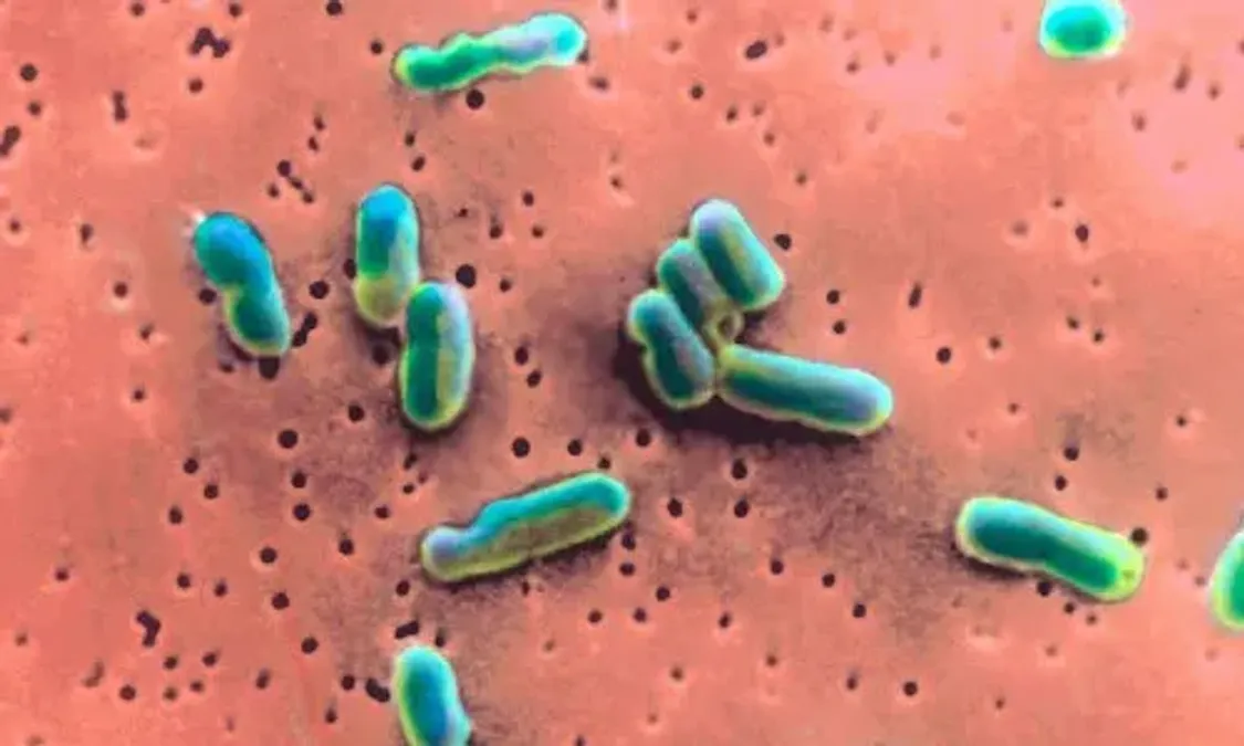 Surge in rare bacterial disease in the US worrying health experts