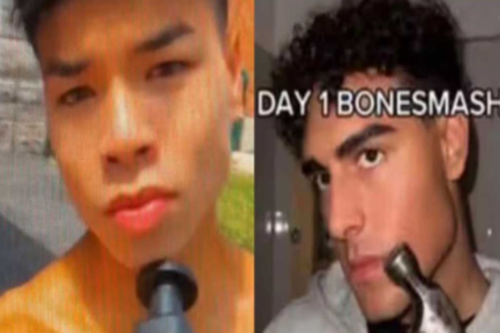 Viral Video: Bone Smashing Trend! People Break Their Facial Bones With ...