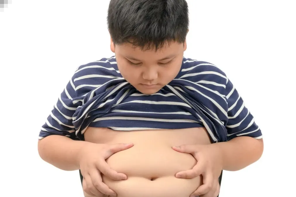 Why Obesity in Kids Should Raise a Red Flag Among Parents? Details Inside