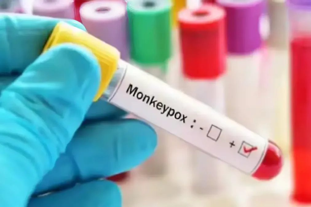 Mpox: Public Health Emergency Declared by WHO; Should India Be ...