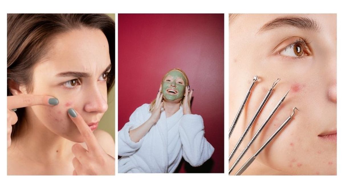 Why Are Gross Pimple Popping Videos So Addictive?