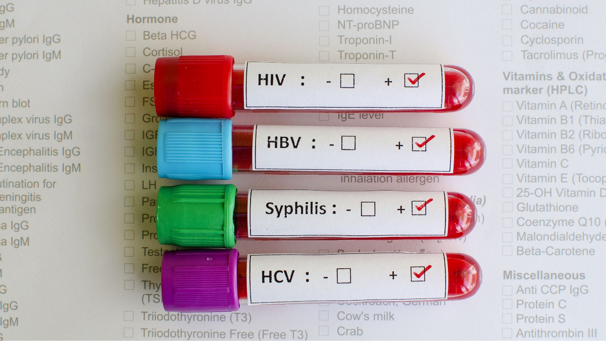 STD Testing Window: क्या है इसका मतलब और महत्व
