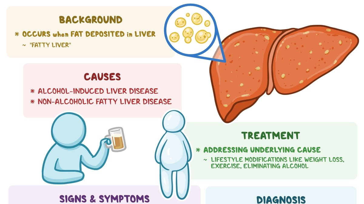 Understanding Steatotic Liver Disease: Early Detection and Prevention ...