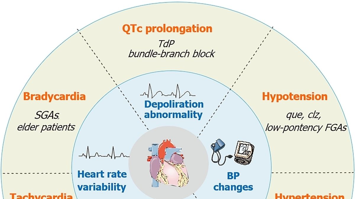 The Link Between Antipsychotic Drugs And Severe Qt Prolongation A