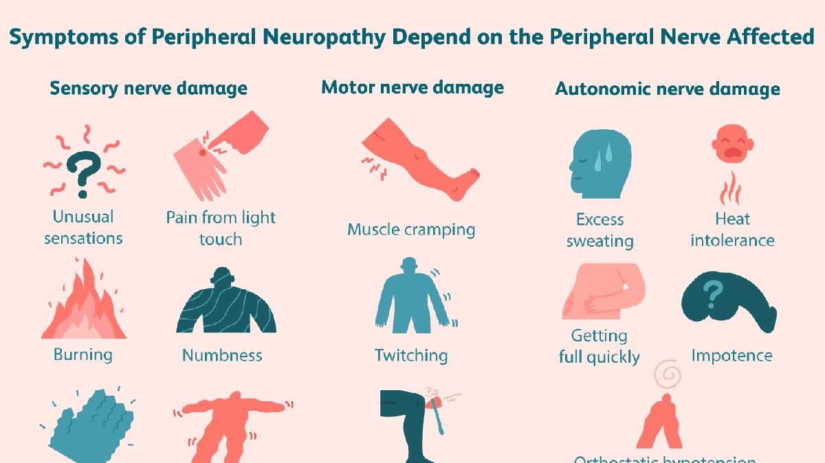 Understanding and Managing Nerve Pain: A Comprehensive Guide