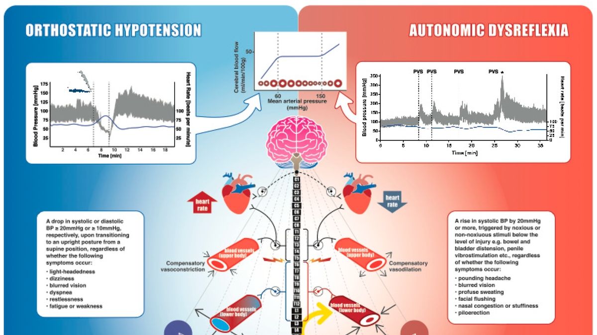 Understanding Orthostatic Hypotension in Individuals with Spinal Cord ...