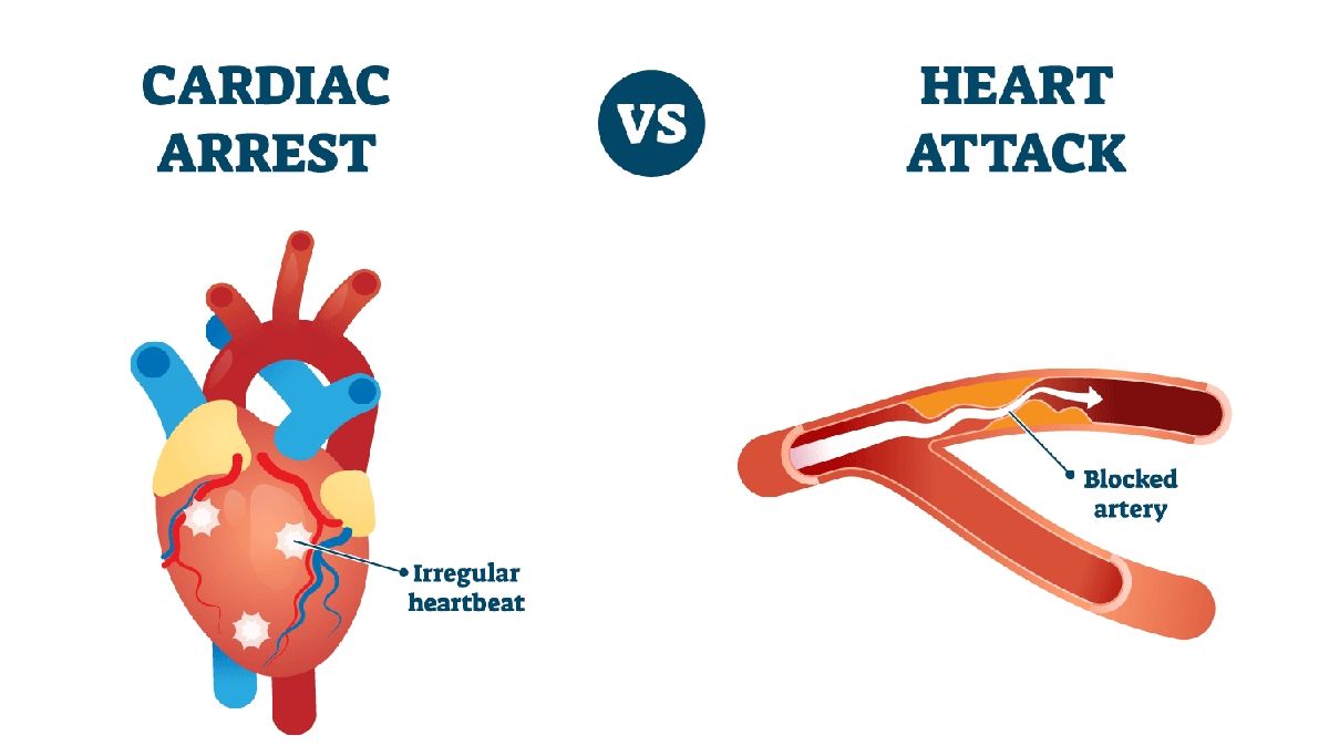 Understanding Sudden Cardiac Arrest Symptoms Intervention And Prevention