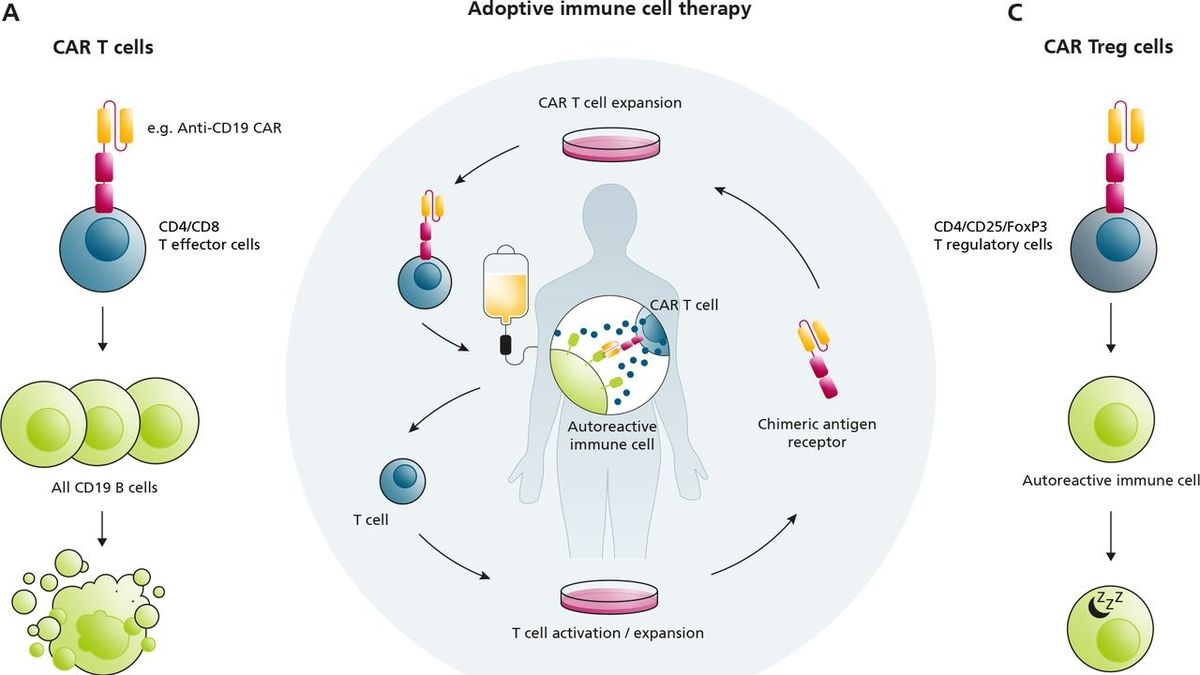 Revolutionizing Autoimmune Disease Treatment: The Promising Role of CD19 CAR T-Cell Therapy
