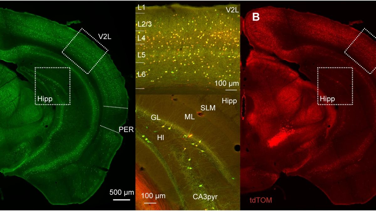 Understanding Cortical Parvalbumin-Expressing Neurons in PV-Cre and ...