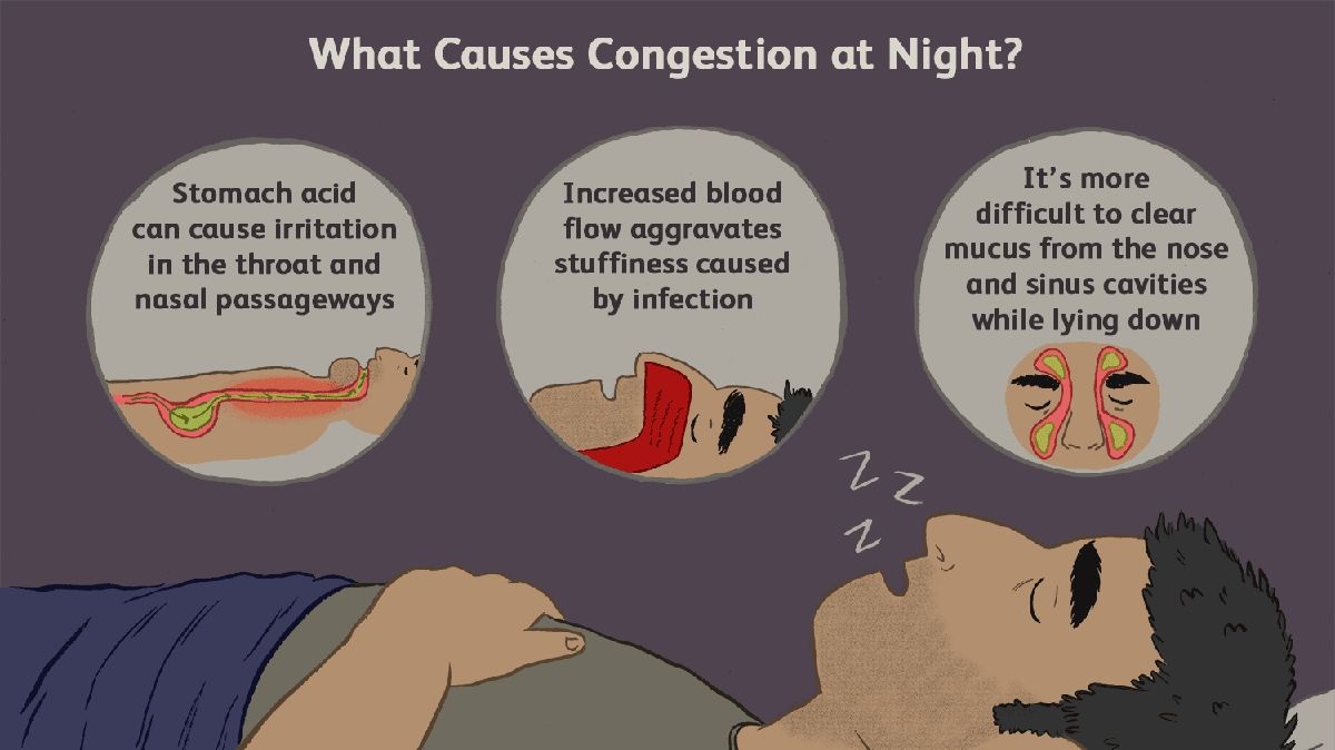 Understanding and Managing One-sided Nasal Congestion
