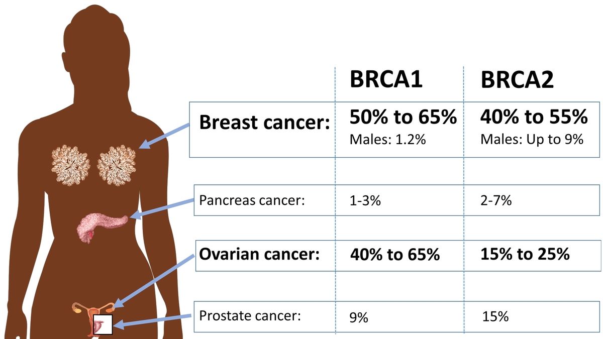 The Potent Role of Risk-Reducing Mastectomies in Lowering Breast Cancer ... The Potent Role of Risk-Reducing Mastectomies in Lowering Breast Cancer ...