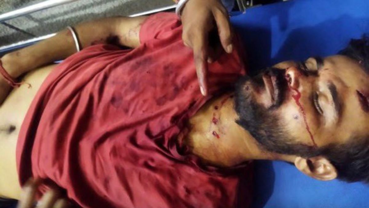 Ram Gopal Mishra died due to shock, excessive bleeding: Bahraich CMO