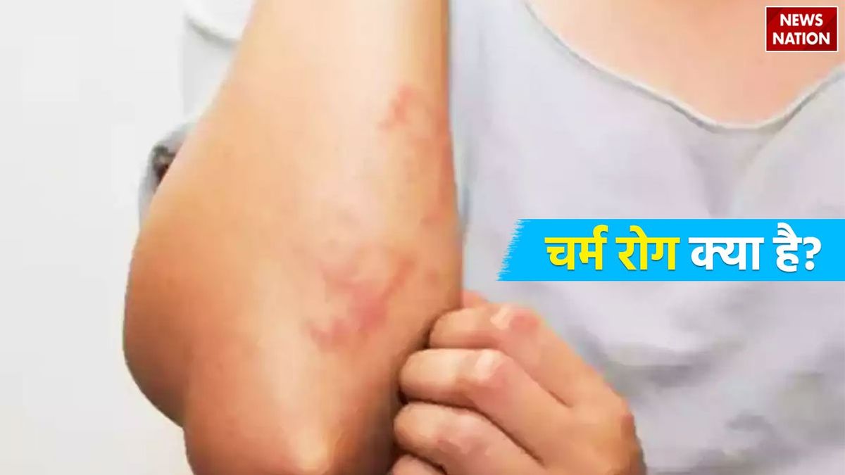 Charm Rog: चर्म रोग क्या है, जानें इसका कारण और सही इलाज