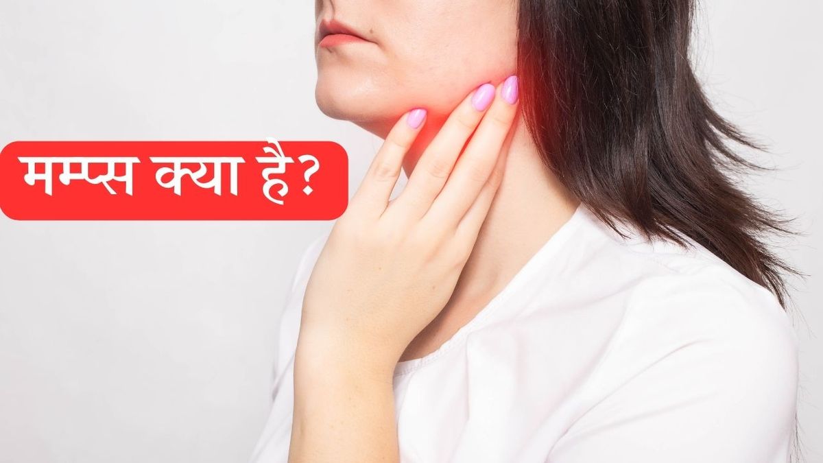 Mumps Disease: मम्प्स क्या है? जानें इसके कारण, लक्षण और इलाज