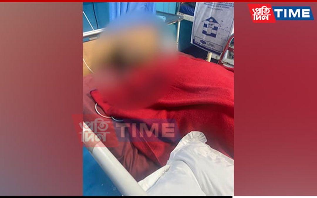 DU Ragging Case: Four More Rusticated