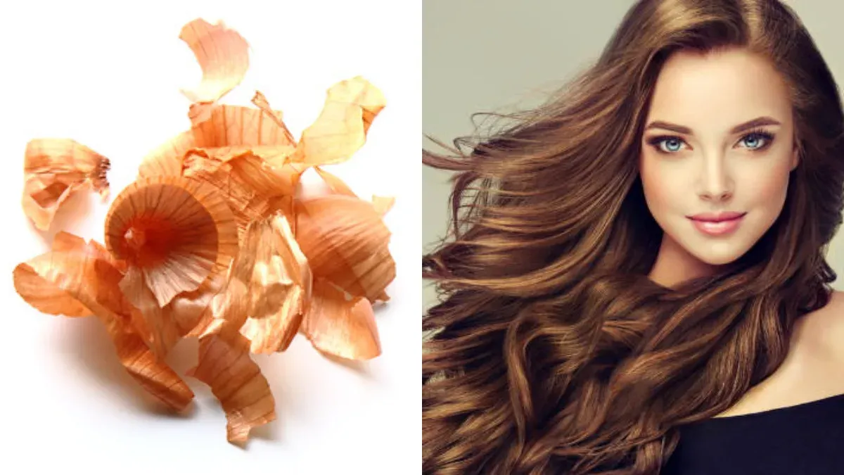 Onion Skin: ఉల్లి తొక్కను పడేయకండి..ఇలా వినియోగిస్తే బోలెడు లాభాలు