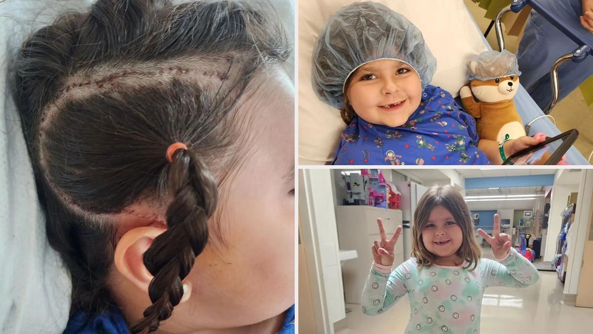 Diagnosed With Rare Disorder, US Girl Has Half Brain Switched Off