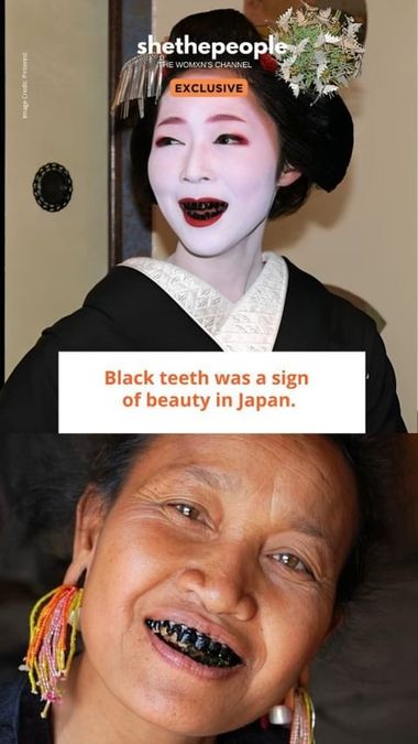 Watch: Was Black Teeth A Sign Of Beauty In Japan?