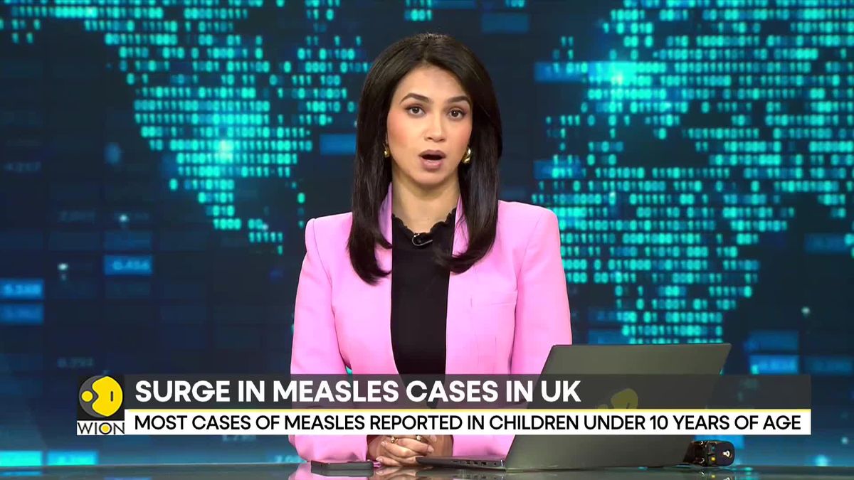 UK Measles Outbreak: Most cases reported in children under 10 years of age