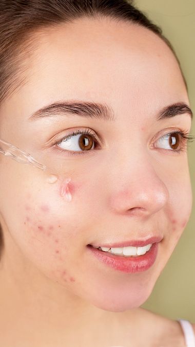 7 Ways to Get Rid of Scars at Home