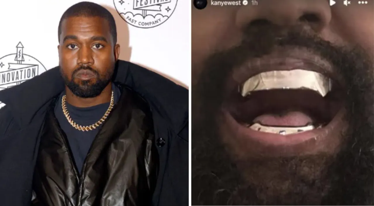 Kanye West shocks fans as he gets $850,000 titanium teeth