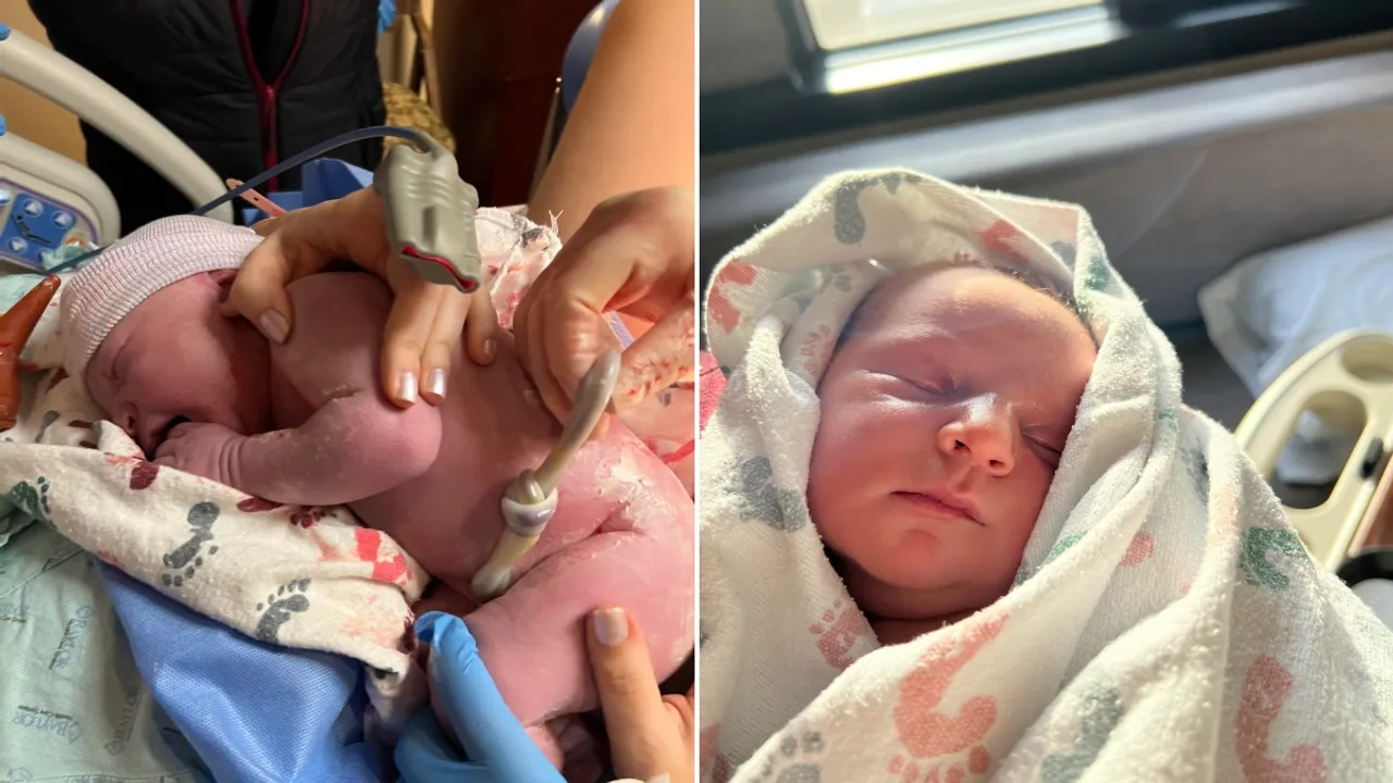 Rare 'True Knot' in Newborn's Umbilical Cord Unites Parents in a Tale ...