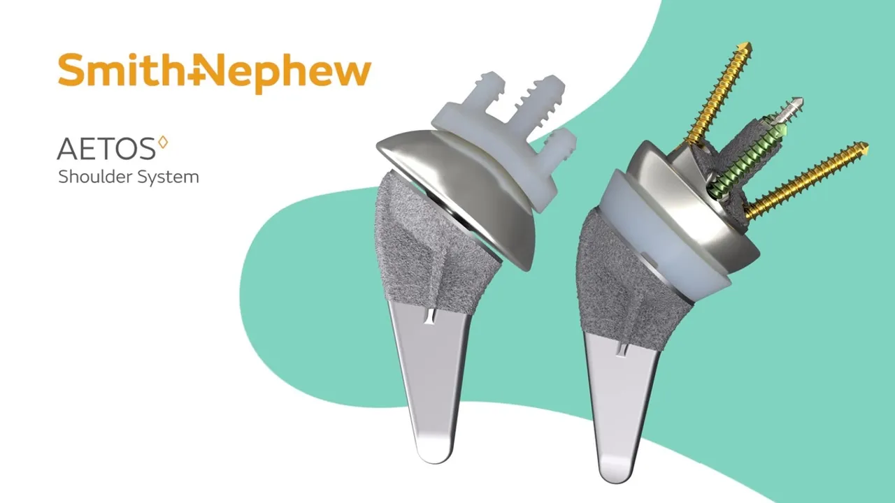 Exactech and Statera Medical Join Forces to Create World's First Smart Reverse Shoulder Implant