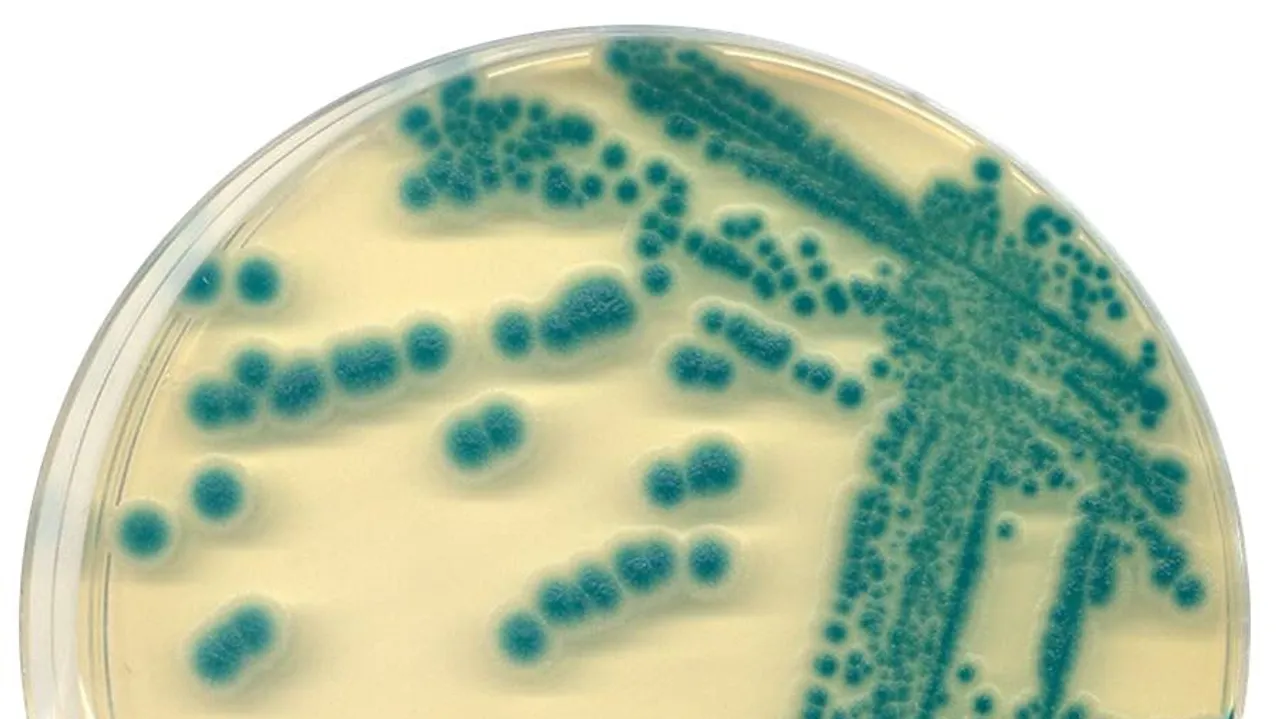 Bacillus Cereus Outbreak in Norway Linked to Popular Porridge Brand ...