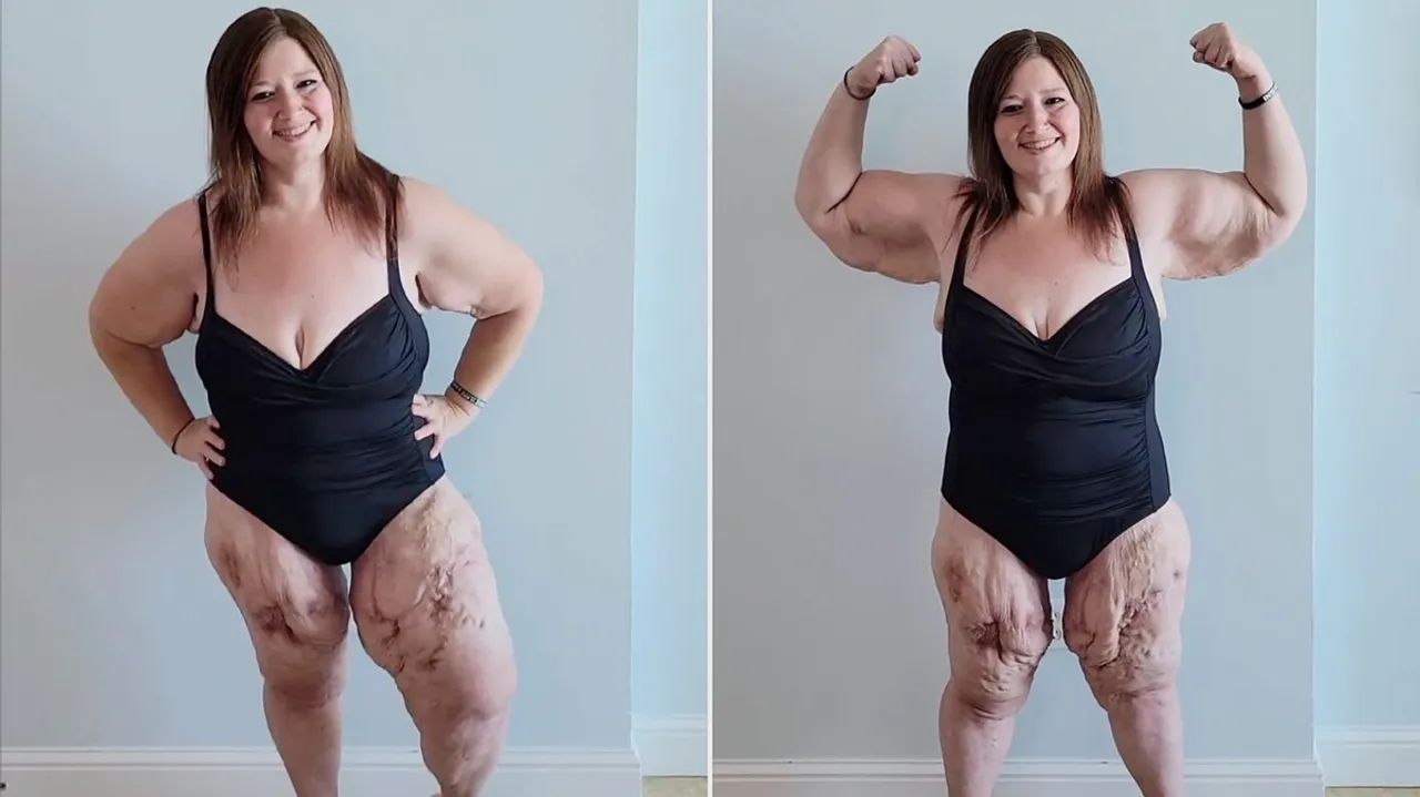 Fitness Influencer Lexi Reed: The Journey of Resilience Beyond Scale