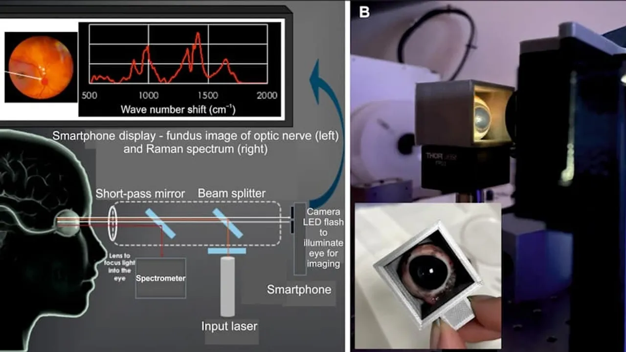 Revolutionizing Ocular Disease Diagnosis: A New Era of Ocular Spectroscopy