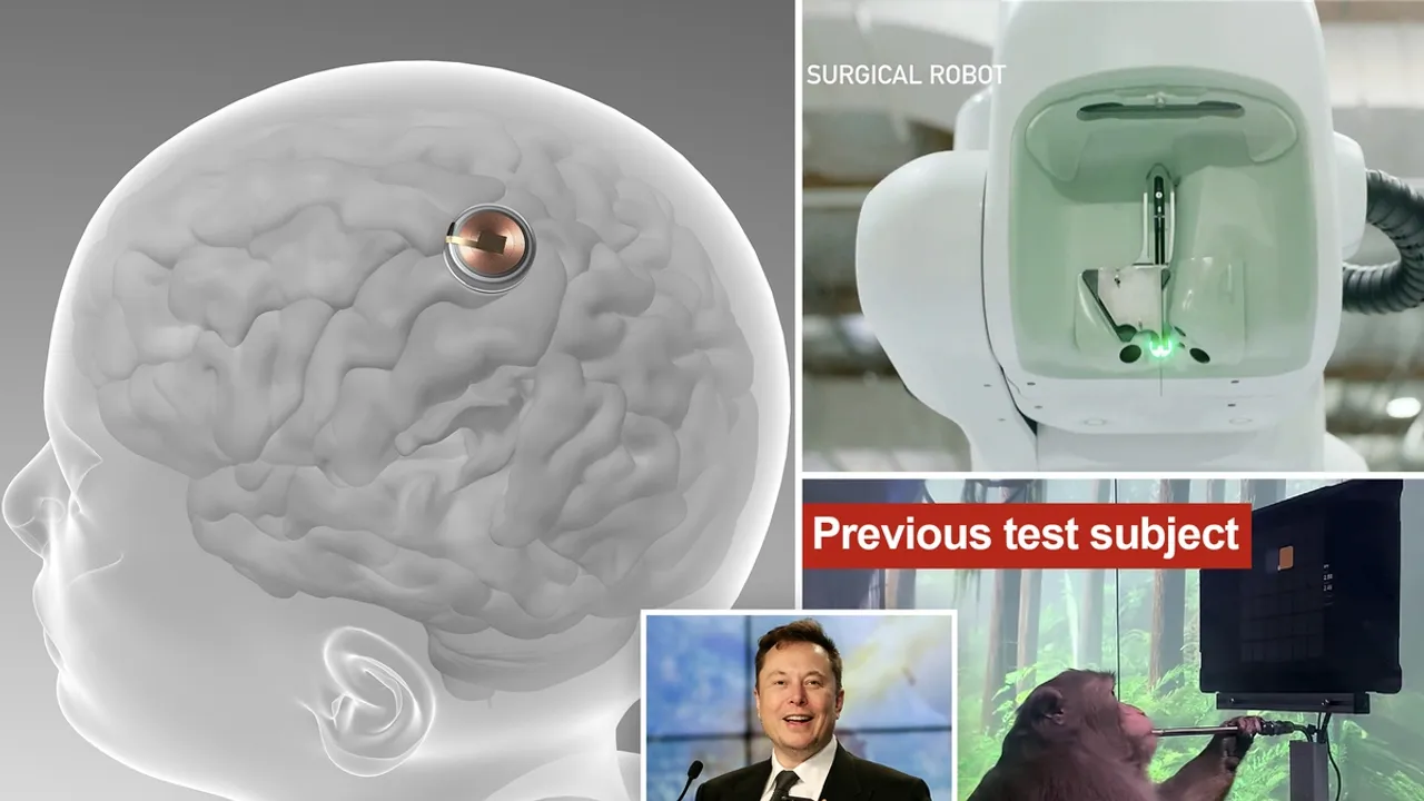 Neuralink Achieves Milestone with First Human Brain Chip Implant