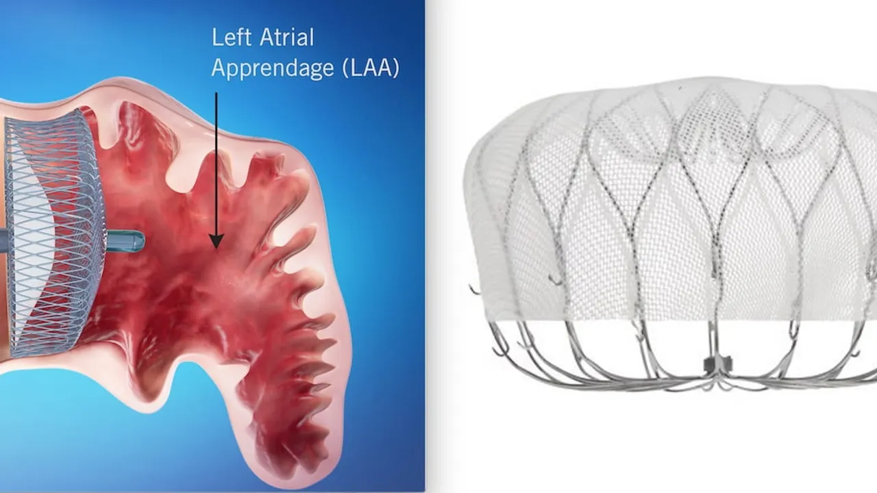 Amulet vs. Watchman FLX: Comparative Study on Percutaneous Left Atrial ...