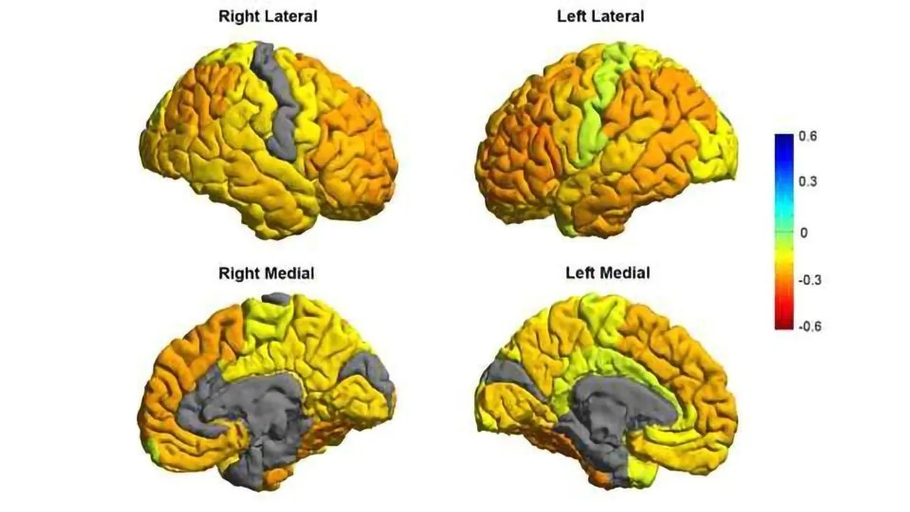 Understanding The Neurobiological Basis Of Bipolar Disorder Subtypes An Insight Into Gray And