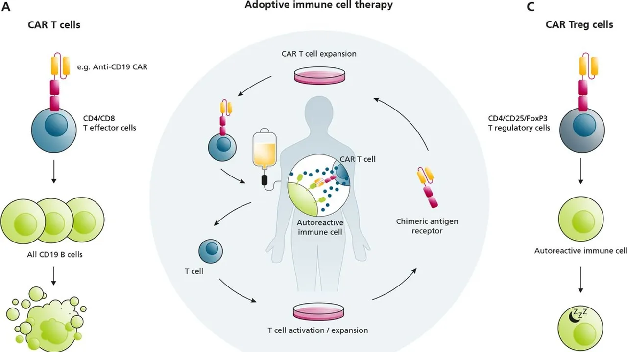 Revolutionizing Autoimmune Disease Treatment: The Promising Role of CD19 CAR T-Cell Therapy