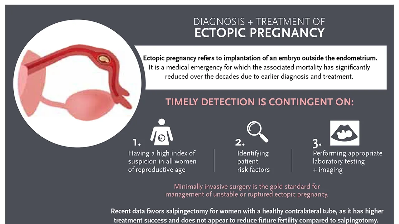 Understanding Ectopic Pregnancy And Miscarriage Timely Diagnosis And