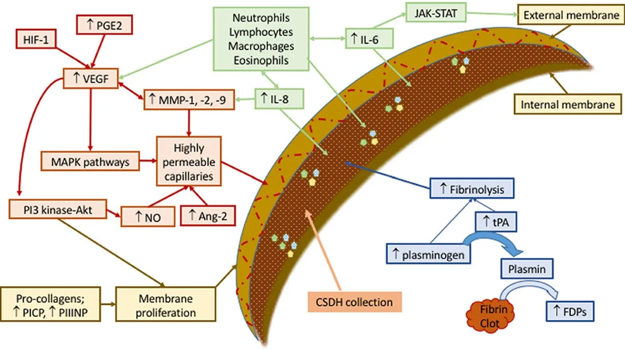 EMBOLISE Trial Revolutionizes Subdural Hematoma Treatment: Reducing ...
