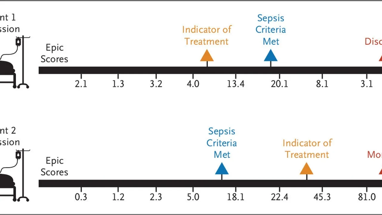 Evaluating The Epic Sepsis Model How Effective Is Ai In Predicting