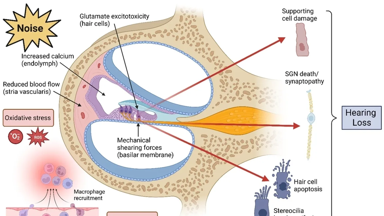Breakthrough Study Reveals Potential Treatment for Noise-Induced ...