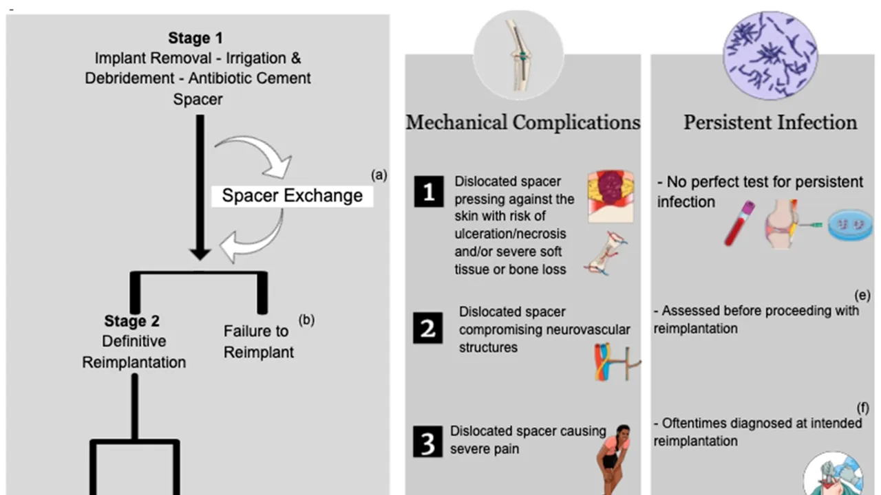 A Comparative Insight Into One Stage And Two Stage Treatment For Periprosthetic Joint Infection